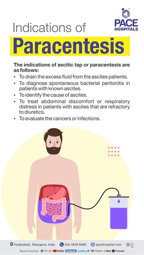 Paracentesis Procedure In Hyderabad Nursing Notes Abdominal Abdominal Discomfort