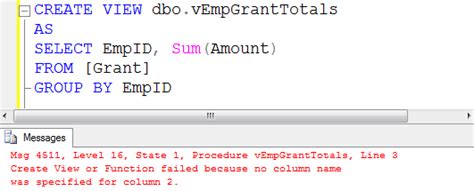 Sql Server Tips From The Sql Joes 2 Pros Development Series