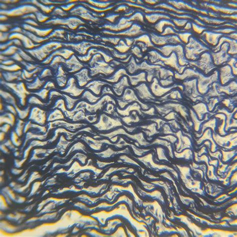 What Are Elastic Stain At Georgia Jarman Blog What Are Elastic Stain At Georgia Jarman Blog