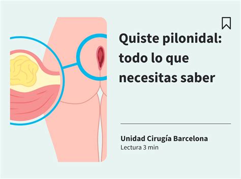 El Quiste Pilonidal Todo Lo Que Necesitas Saber Unidad Cirugia Barcelona