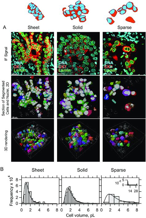 Tumor Tissue Organization Correlates To The Extent Of Cell Size