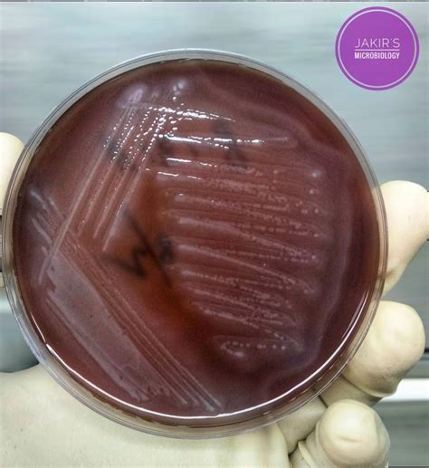 ☞which Bacteria Exhibit Swarming ️comment Your Answer Jakir Hosen