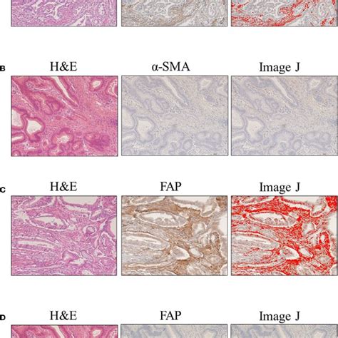 Evaluation Of α Smooth Muscle Actin α Sma And Fibroblast Activation Download Scientific