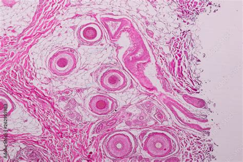 Education Anatomy And Physiology Of Human Scalp Show Of Hair Folticles Under The Microscopic In