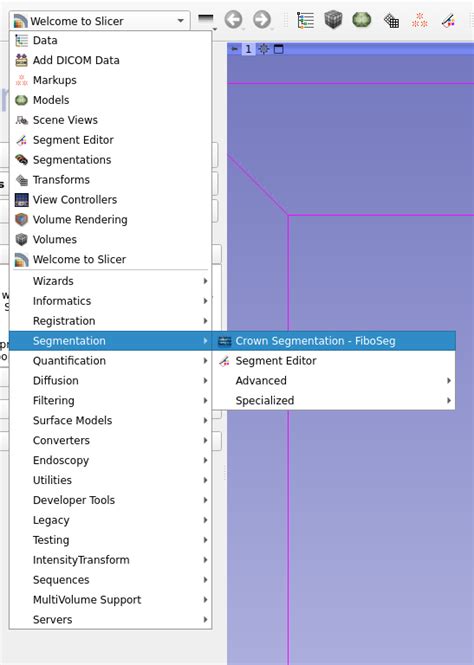 Slicerdentalmodelseg User Tutorial — Slicersalt Documentation Documentation