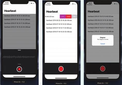 Heartbeat Abnormality Detection Download Scientific Diagram