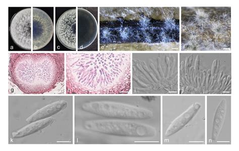 Botryosphaeria Eriobotryae Facesoffungi Number Fof 12930 Faces Of