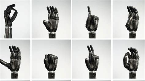 Watch Us Firms Bionic Hand With 32 Grip Patterns Brings Sense Of Touch To Prosthetics