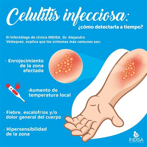 Celulitis Infecciosa ¿en Qué Consiste Y Cómo Puedes Tratarla A Tiempo