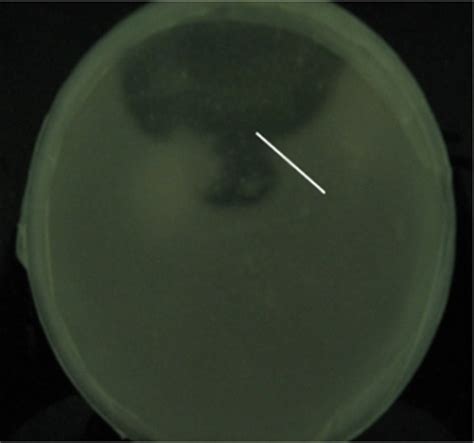 Production Of Oxalate Oxidase From Endophytic Ochrobactrum Intermedium Cl6 Journal Of Pure And