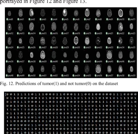 Figure From MRI Image Segmentation Using Deep Learning For Brain Tumor Detection Semantic