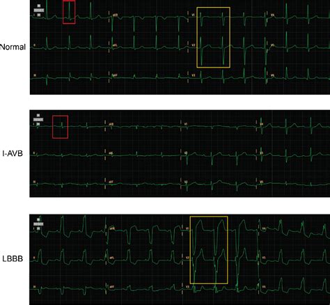 Figure 7 From Modeling Multivariate Biosignals With Graph Neural