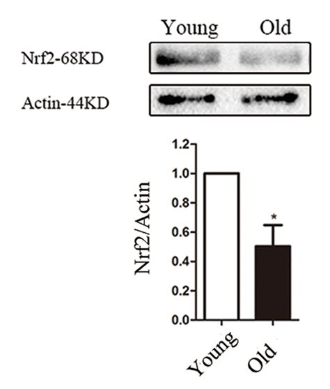 Sirt1 Nrf2 Pathway Is Involved In Oocyte Aging By Regulating Cyclin B1