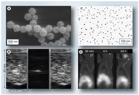 Silver Nanoparticles As Contrast Agents In Biomedical Imaging A