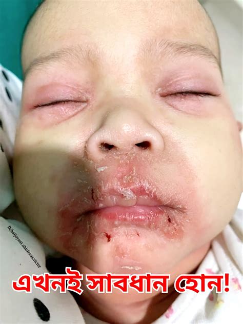 বৈজয়ন্ত আপনার বাচ্চাকে কেউ যদি চুমু খেতে চায় তাকে ভদ্র ভাষায় থামতে বলুন। যদি সে আপনার কথা