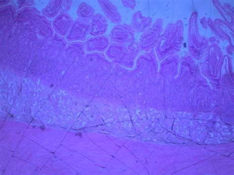 Duodenum Cross Section 4x Diagram Quizlet