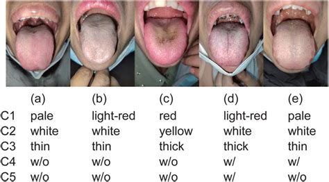 Ssc Net A Multi Task Joint Learning Network For Tongue Image Segmentation And Multi Label