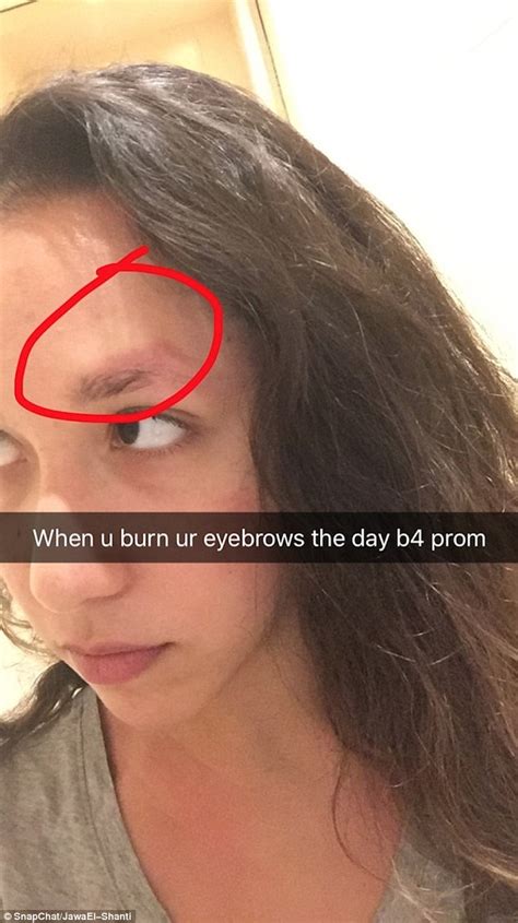 Jordan Teenager Is Left With Singed Eyebrows The Day Before Her Prom