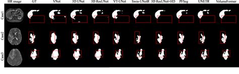 Figure 7 From Adaptive Decomposition And Shared Weight Volumetric
