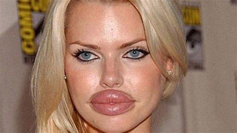 Lifes A Botch The Government Cracks Down On Unlicensed Botox And
