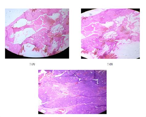 A 7c Histopathological Slide Comprises Of Salivary Gland Showing