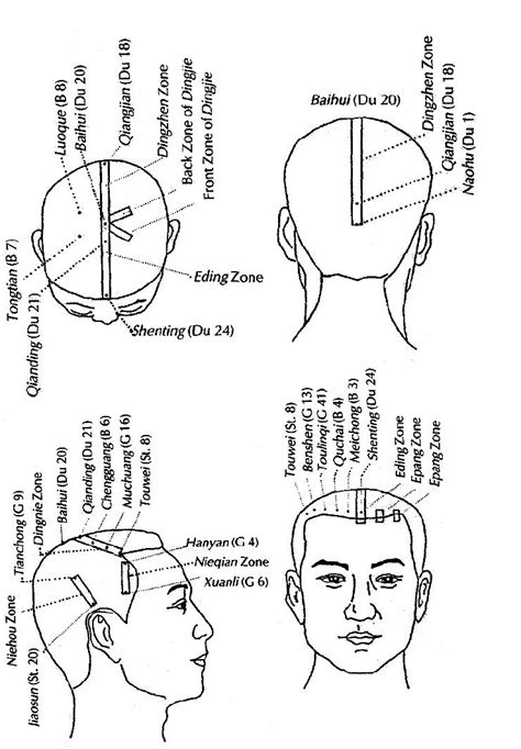 Scalp Acupuncture Points Chart Educational Chart Resources