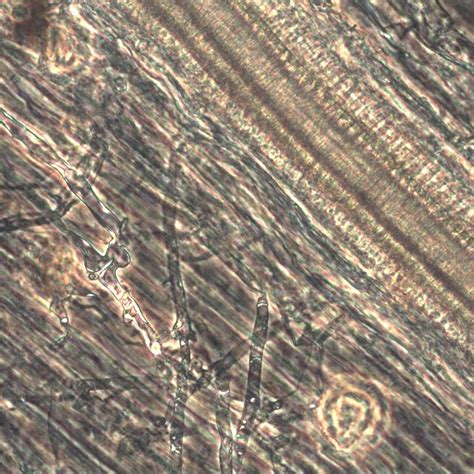 Disease Suppressive Trichoderma Spp Isolated From Compost Growing On Download Scientific