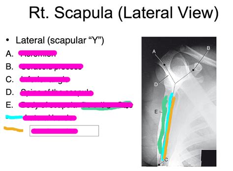 Diagram Of MODULE Lateral Scapula X Ray Quizlet