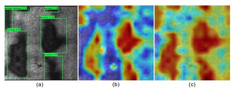 Improved Yolov7 Based Steel Surface Defect Detection Algorithm