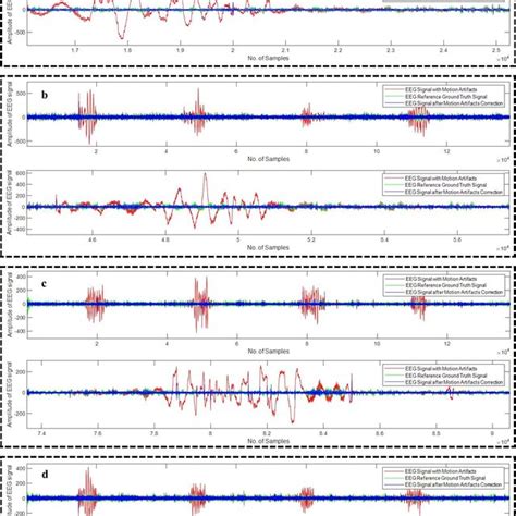 Motion Artifact Correction From Example Fnirs Signals Using Wpd Sym5 Download Scientific