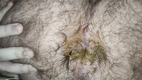 Winking Dirty Hairy Butt Thisvid Com