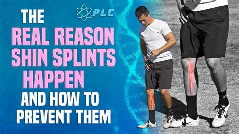 Do Insoles Help Prevent Shin Splints At Christopher Brunell Blog