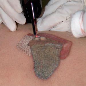 How Light Microscopes Work HowStuffWorks