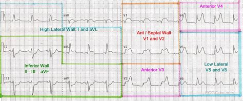 12 Lead Interpretation Chart Chartdevelopment