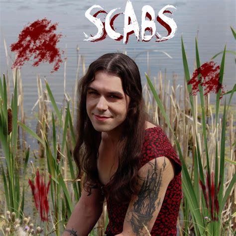 Scabs Youtube Music