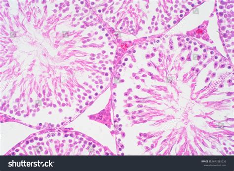 Human Testis Under Microscope View Shows Foto Stock 1673285236
