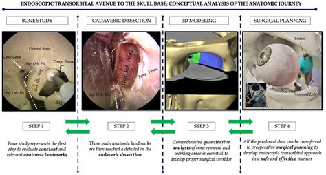 Endoscopic Skull Base Anatomy