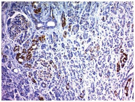 Ncam 1cd56 Antibody 123a8 Same As 56c04 Novus Biologicals 002mg