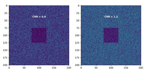 Improving Tumor Detection In X Ray Images Using Monte Carlo Simulation Based Optimization Nhsjs