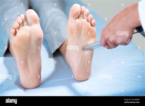 Female Doctor Testing Patient S Plantar Reflex Stock Photo Alamy