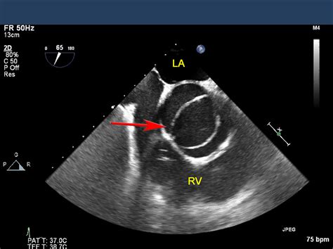 The Year In Perioperative Echocardiography Selected Highlights From
