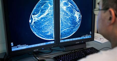 What Your Mammogram Can Tell You About Your Cardiovascular Health