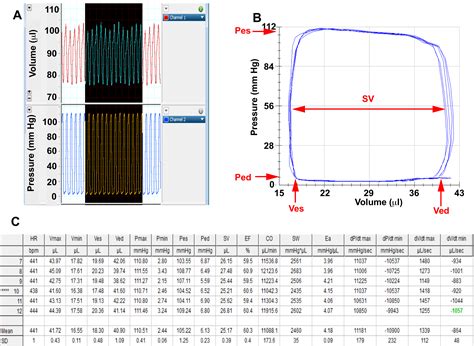 Video Cardiac Pressure Volume Loop Analysis Using Conductance Catheters In Mice