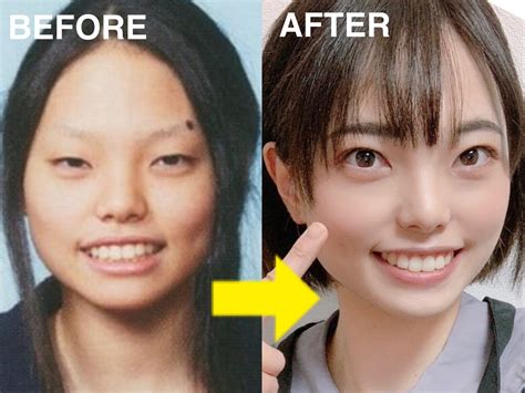 「ぼる塾」はるちゃんが「整形」をした理由【思い、思われ、食べ、ぼる塾。vol68】 Cancamjp（キャンキャン）