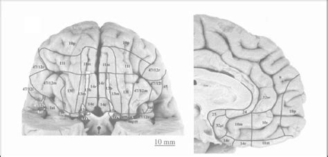 13 1 Architectonic Maps Of The Orbital And Medial Prefrontal Cortex In