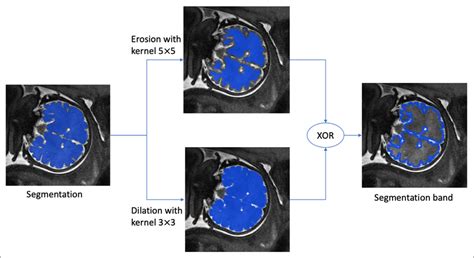 Illustration Of The Segmentation Offset Band Extraction Method Using
