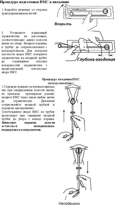 Установленная вмс
