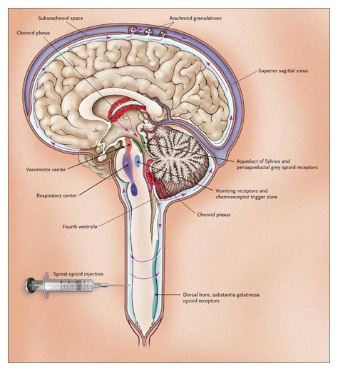 Paracervical Block During Labor