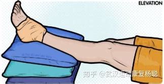 脚踝有哪些常见的损伤你的踝关节疼痛代表什么损伤 知乎