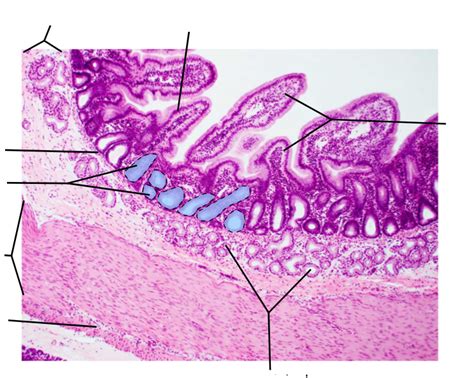 Duodenum Diagram Quizlet